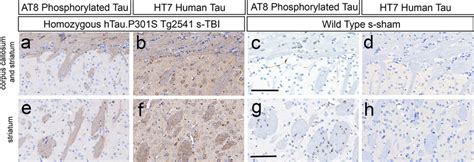 Tau Phosphorylation In Axons And Oligodendrocytes A B After S Tbi In Download Scientific