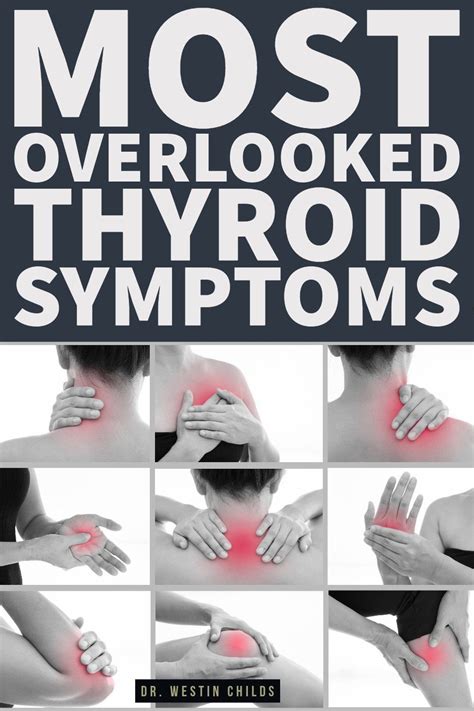 Symptoms Of Hypothyroidism Artofit