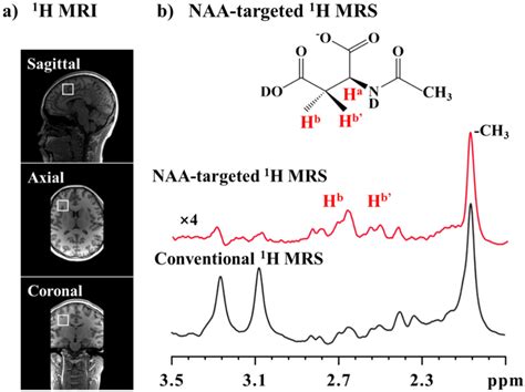 A Routine Mri Images Showing The Voxel Position In The Human Brain
