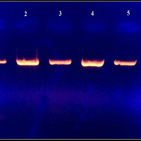 Pcr Amplification Of Emetic Toxin Gene M Ladder 2 Positive For