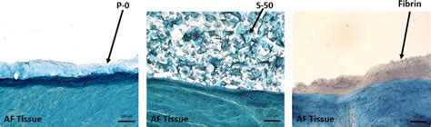 Histological Staining Of Formulations P‐0 S‐50 And Fibrin Control