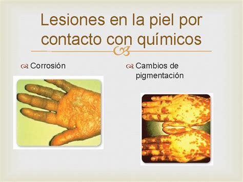 Principales Peligros En El Laboratorio Sustancias Qumicas De
