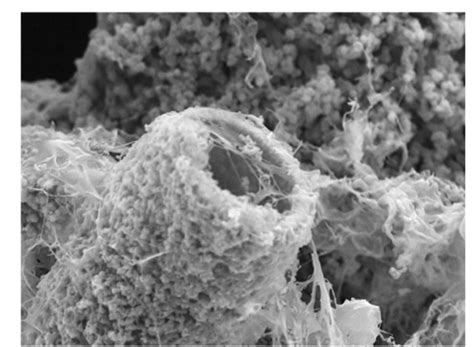 Scientists Create Chemical Gardens That Can Be Used As Bone