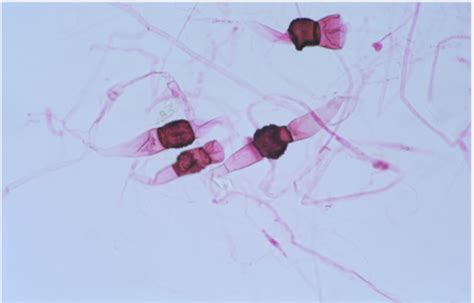 Lab 18 Fungi Flashcards Quizlet