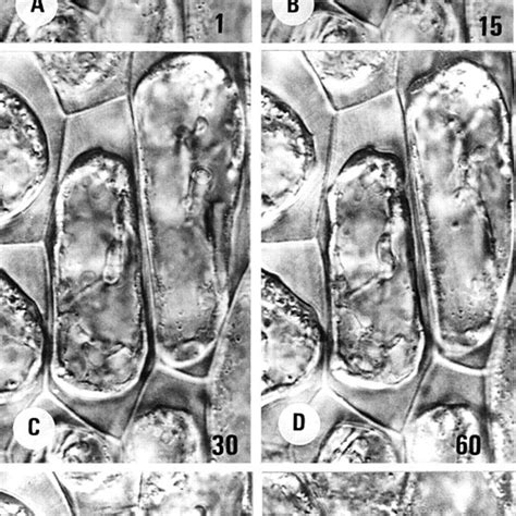 A Almost All Afs In This Plasmolysed Cell Are Located Within The Download Scientific Diagram
