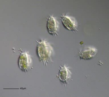 Fotos Gratis Agua Soltar Biología Azul Circulo Protista Protisten Einzeller Protozoos