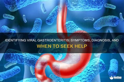 Identifying Viral Gastroenteritis Symptoms Diagnosis And When To Seek Help Medshun