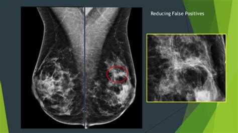 Can Cpt Code 29806 And 29827 Be Billed Together