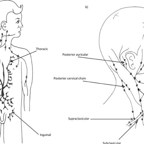 Cervical Lymph Node Drainage And Selected Causes Of Localised