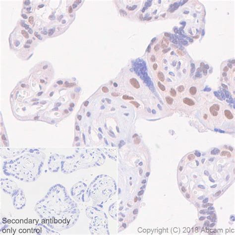 Anti Cyclin E1 Antibody Sp146 Ab135380 Abcam
