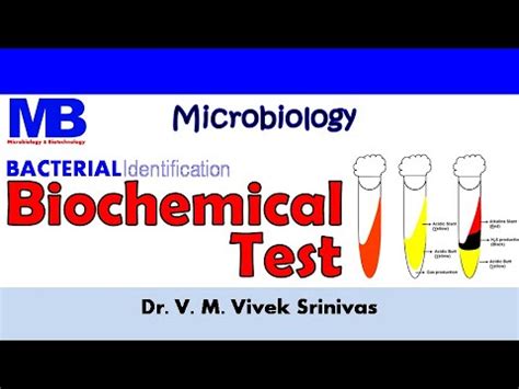 Biochemical Test Bacterial Identification Technique Microbiology