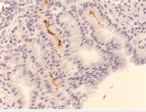 Positive Immunohistochemical Staining For Helicobacter Organisms