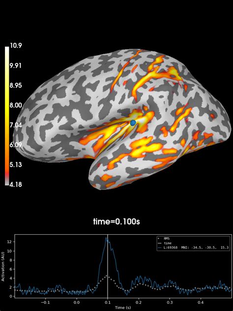 Eeg Source Localization Given Electrode Locations On An Mri — Mne 1110 Documentation