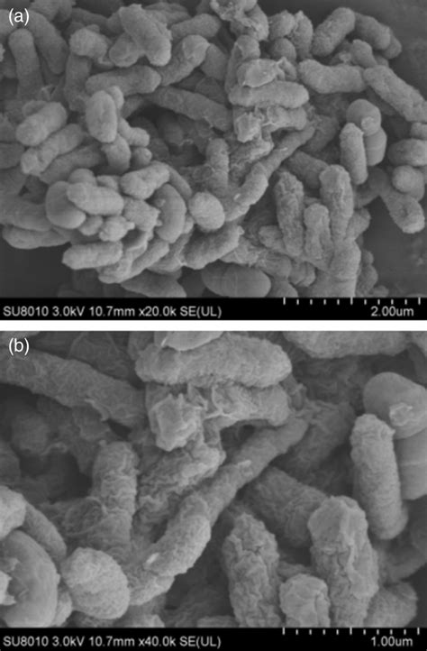 The Sem Photos Of Electricity‐producing Bacteria Download Scientific
