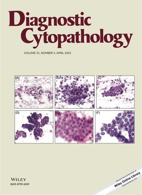 Diagnostic Cytopathology On Linkedin Dicy Cytopath Path2path