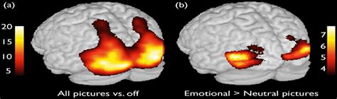 Affective Picture Perception Gender Differences In Visual C