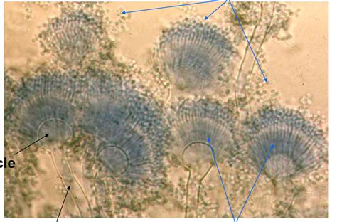 Diagram Of Fungal Physiology Quizlet