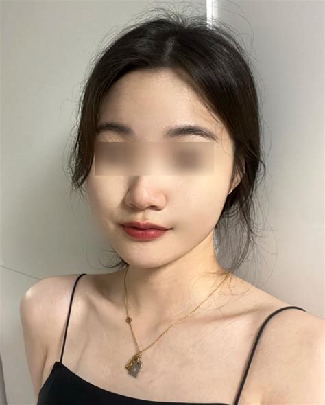 입체성형외과의원 매끈하고 예쁜 광대를 가지는 방법 입체 안면윤곽 입체성형외과에서