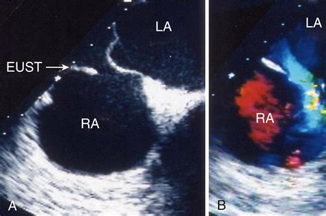Normal Anatomic Variants And Artifacts Clinical Tree