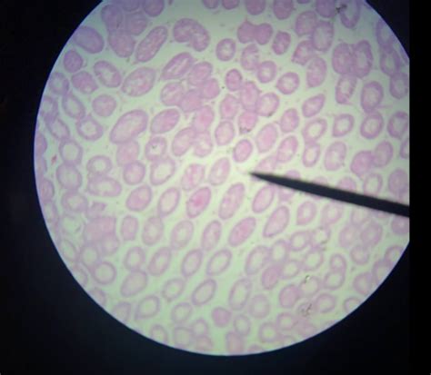 Reproduction Slides Flashcards Quizlet