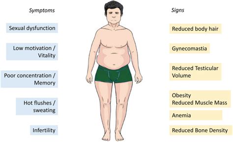 Adult And Late Onset Male Hypogonadism The Clinical Practice