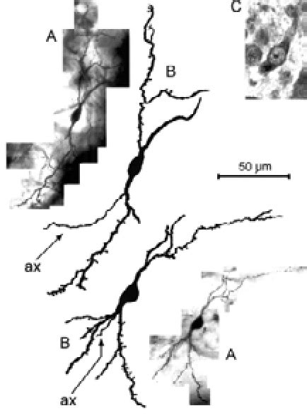 The Fusiform Neurons A — Non Clarified Golgi Impregnation B