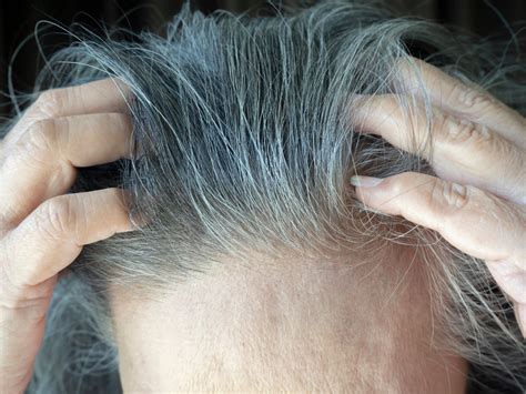 How To Deal With With Graying Thinning And Other Hair Problems Of