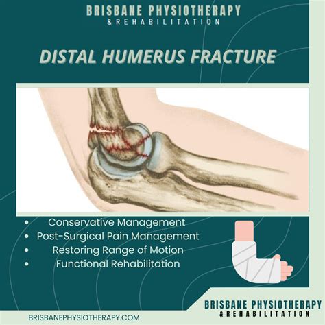 Distal Humerus Fracture Recovery And Rehabilitation Brisbane