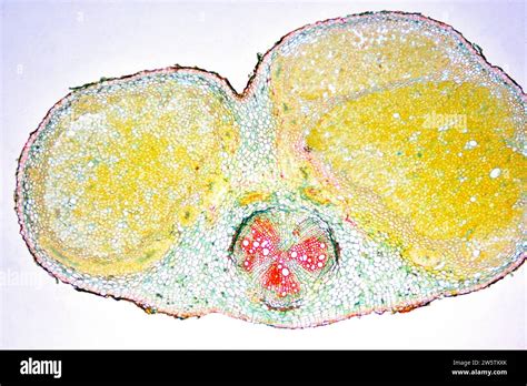 Root Nodules With Nitrifying Bacteria Bradyrhizobium Japonicum In