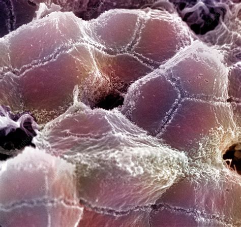 Mouse Liver Sem Stock Image C0031919 Science Photo Library