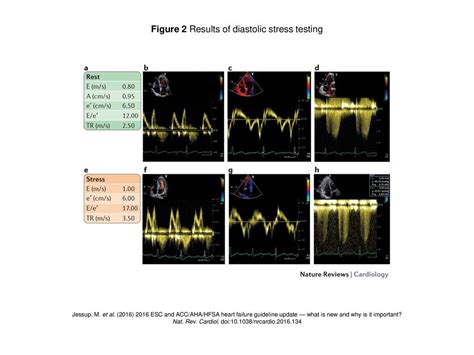 Diastolic Stress Test Invasive And Noninvasive Testing