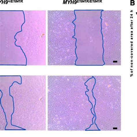 Myh9 E1841k Mutation Enhances Podocyte Migration In Vitro A Upper
