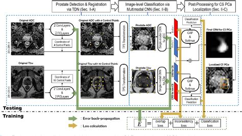Figure 1 From Automated Detection Of Clinically Significant Prostate Cancer In Mp Mri Images