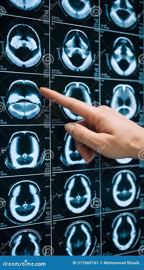 Grid Of Head And Neck Mri Scans With Hand Pointing For Diagnosis Stock Illustration