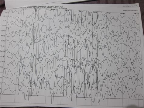 Img 0002 — Postimages