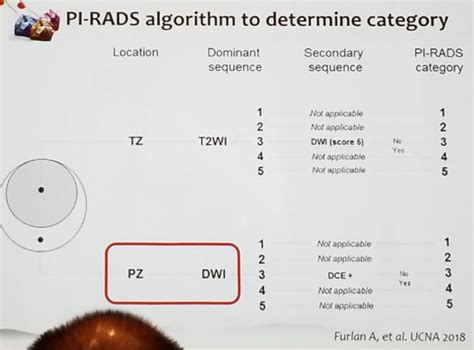 Siu 2018 Mri Should Be Performed In All Patients Prior To Biopsy