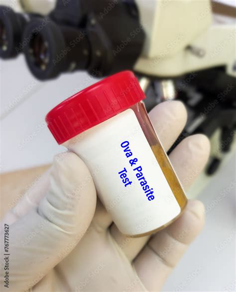 Stool Test Sample For Ova And Parasitesop Test Giardia And