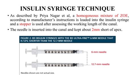 Obturation Techniques In Primary Teeth Pptx Dental Health