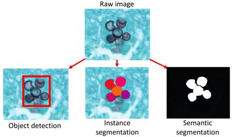Here A Cluster Of Paracoccidioides Brasiliensis Cells Are Annotated In