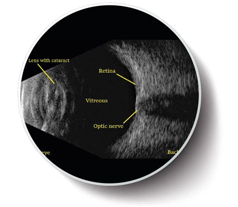 Topography Unit Surgical Eye Center