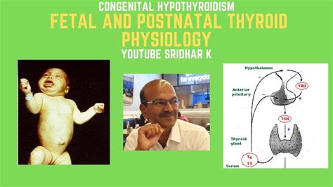 Fetal And Postnatal Thyroid Physiology Hypothyroidism