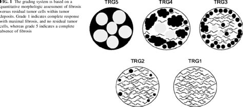 The Grading System Is Based On A Quantitative Morphologic Assessment Of