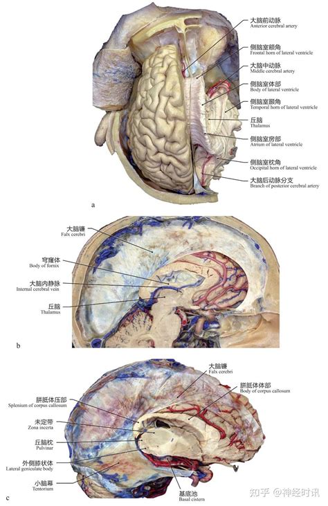 脑干的内部解剖、表面解剖（内附详细标注解剖图） 知乎
