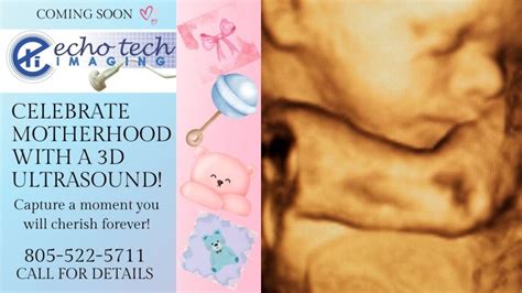 Echo Tech Imaging On Linkedin Mothersday2024 Ultrasound Echo Tech Imaging 4d Butter