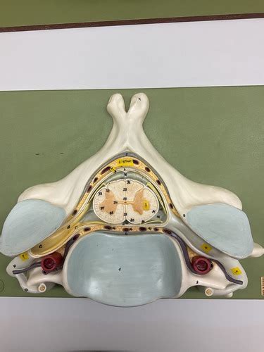 Spinal Mock Practical 2 Flashcards Quizlet