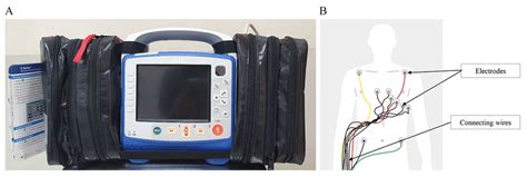 A The Conventional 12 Lead Electrocardiogram Device Used For The