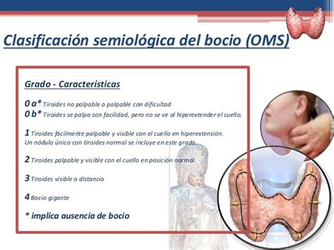 Bocio Ana M Ibargüen