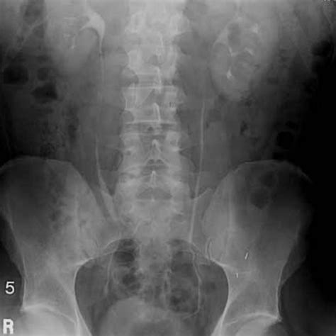 Radiology Ivp Altis Hospital