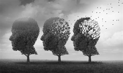 Understanding The Stages Of Memory Loss Santé Cares