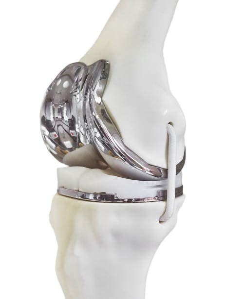 210 Kapsul Sendi Foto Foto Stok Potret And Gambar Bebas Royalti Istock